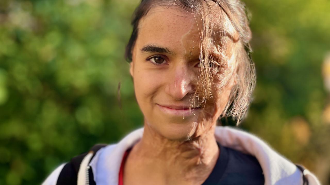 Den Blitzschlag überlebt - ZDFmediathek