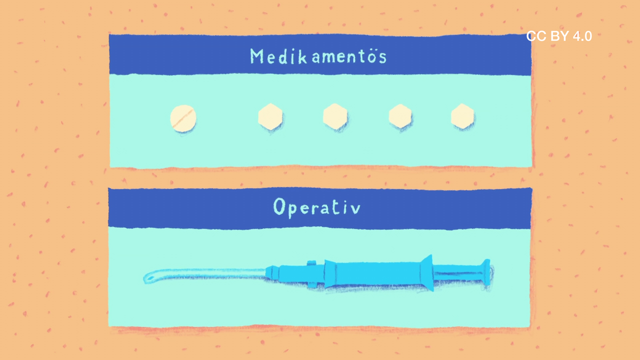 Schwangerschaftsabbruchmethoden Deutschland CC