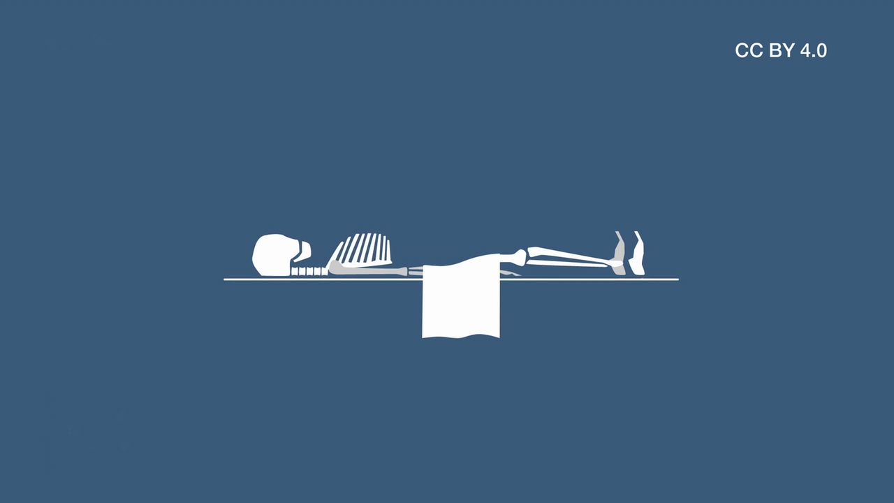 Verwesung Körper CC